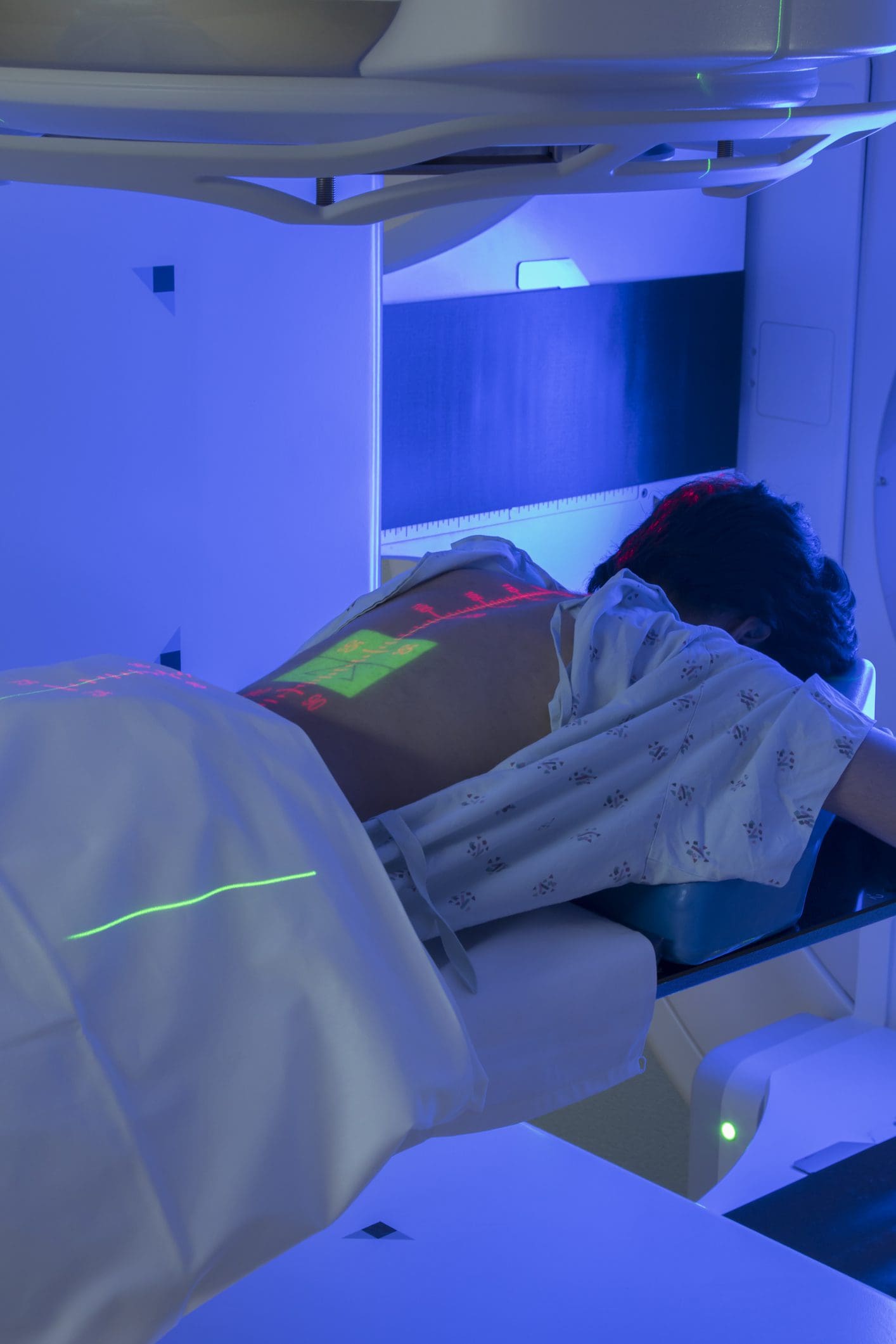 Patient Receiving Radiation Therapy Treatments for Cancer - Give BSMH